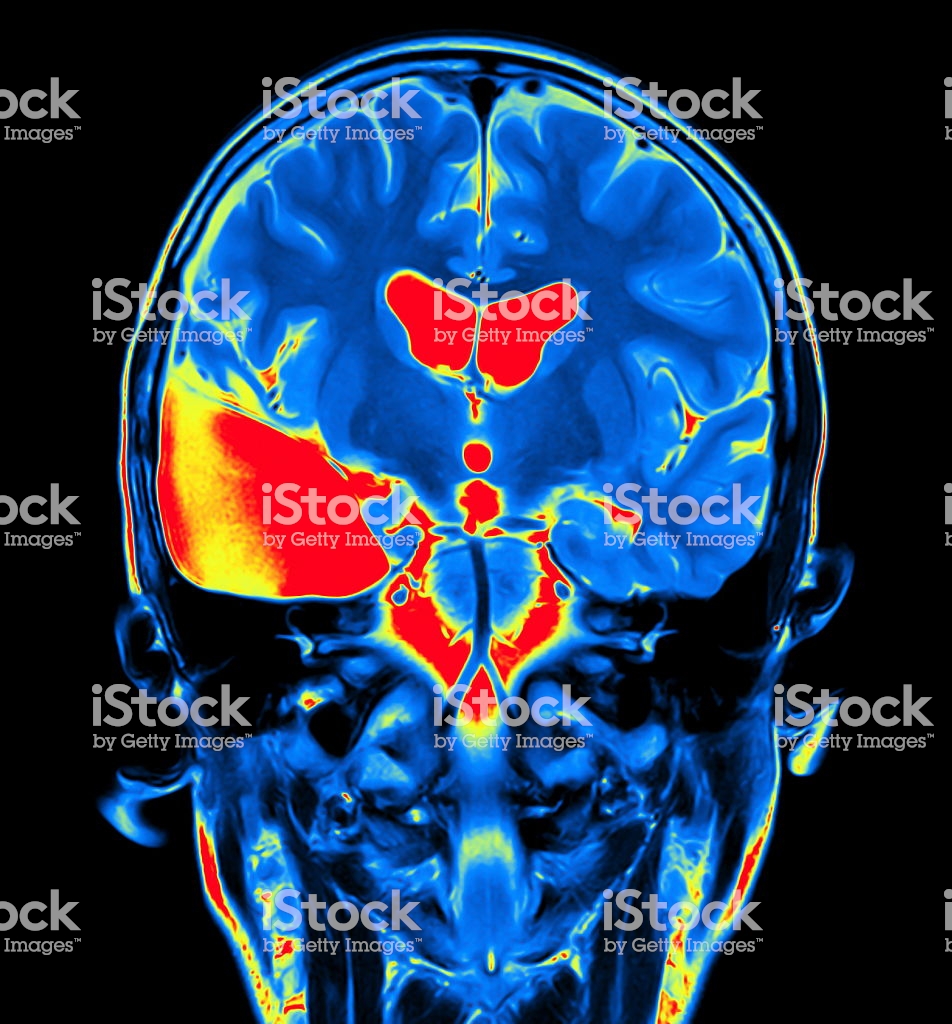 scan wallpaper,medical imaging,head,medical,brain,organ (#487917 ...