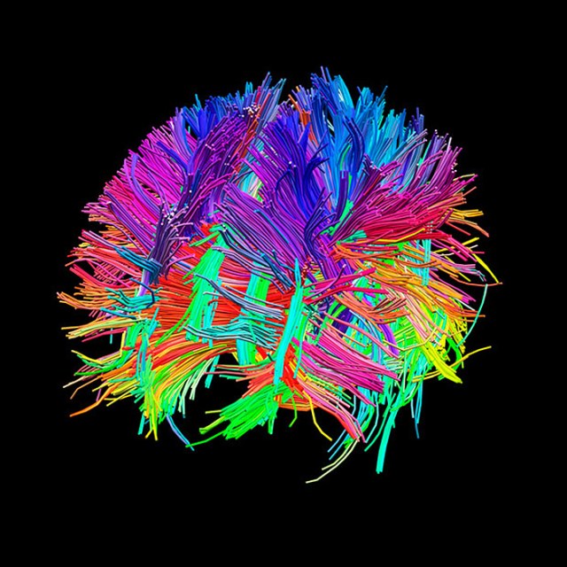 Human Connectome Project- WallpaperUse